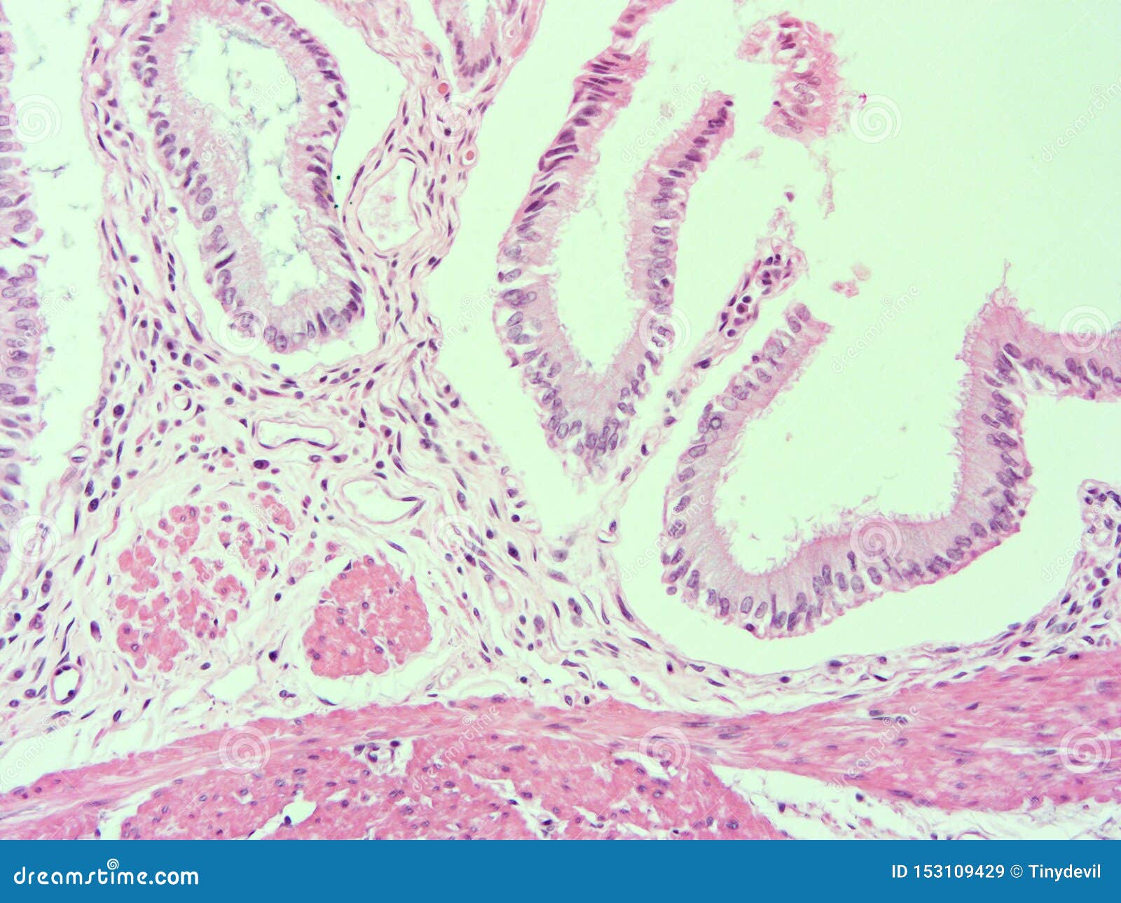 Histology of Human Gallbladder Tissue Stock Image - Image of columnar ...