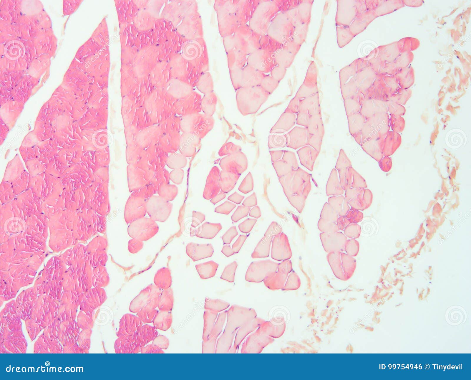 Histology Of Human Muscle Tendon Connection Tissue Stock Photography ...