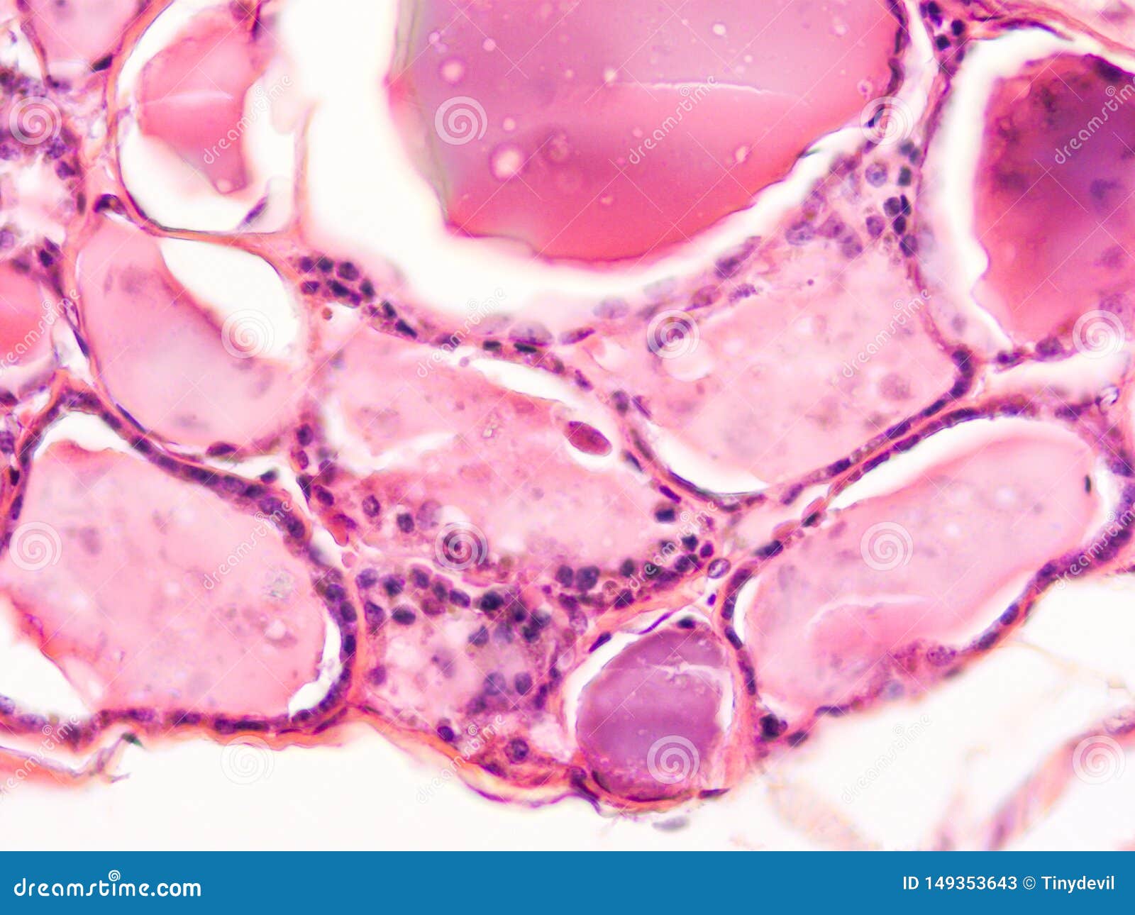 Histology of Human Thyroid Gland Tissue Stock Image - Image of human ...