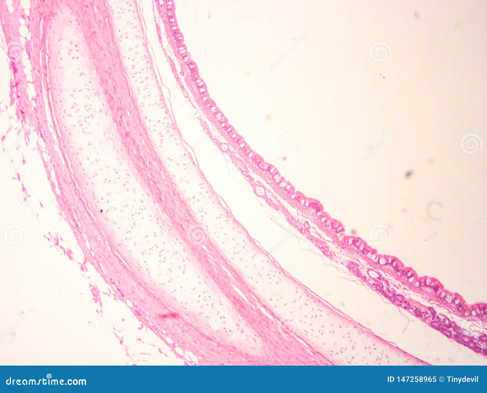 Histology of Trachea Human Tissue Stock Image - Image of study, biology ...