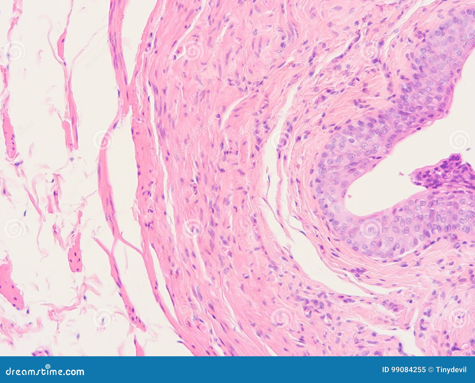 Histology of human tissue stock image. Image of science - 99084255