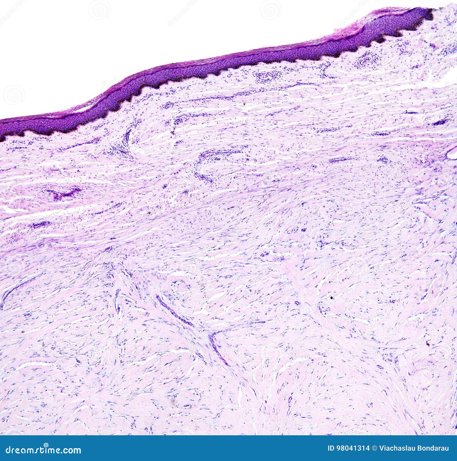 Histology of Human Tissue, Show Skin As Seen Under the Microscope Stock ...