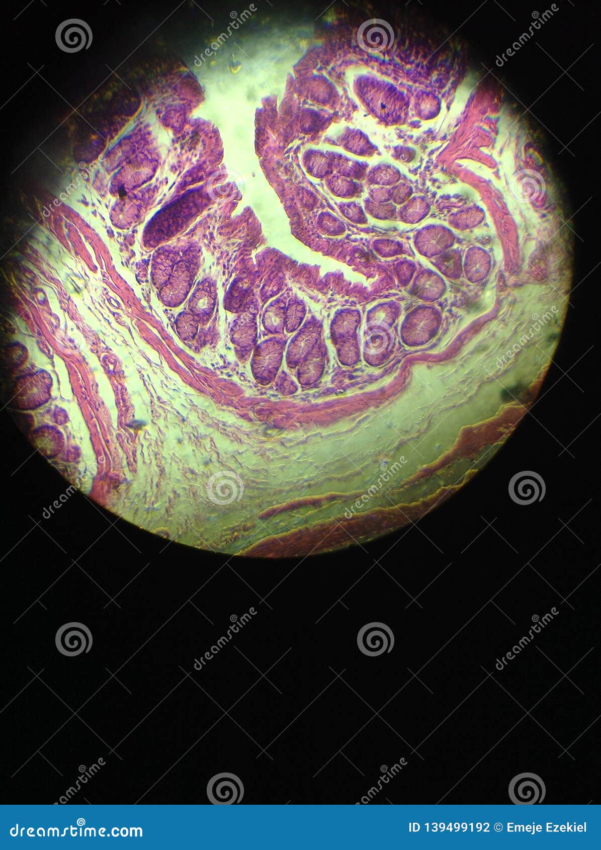 Frog Kidney Histology