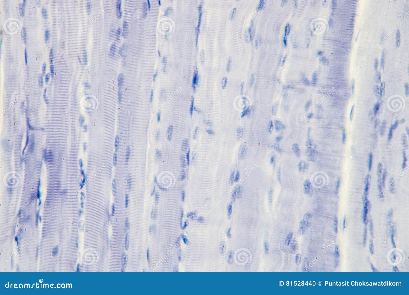Histology of Skeletal Muscle Stock Photo - Image of health ...