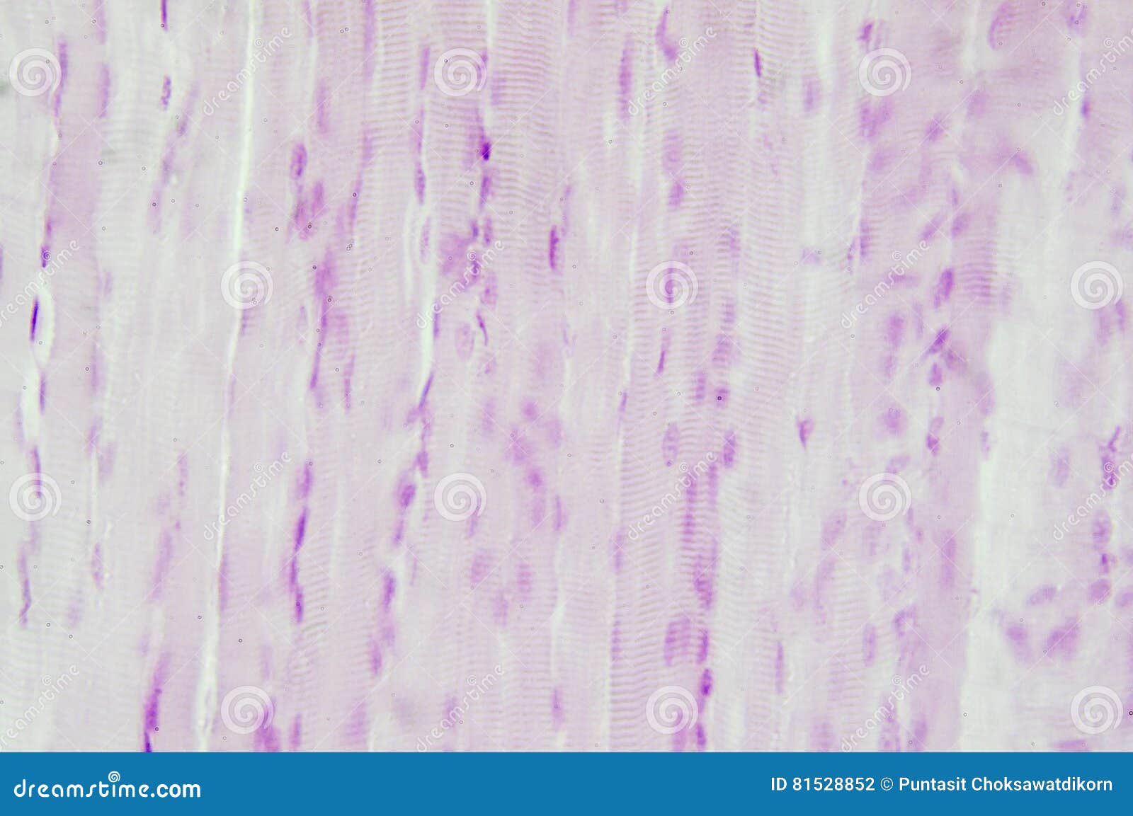 Histology of Skeletal Muscle Stock Photo - Image of anatomy, fibers ...