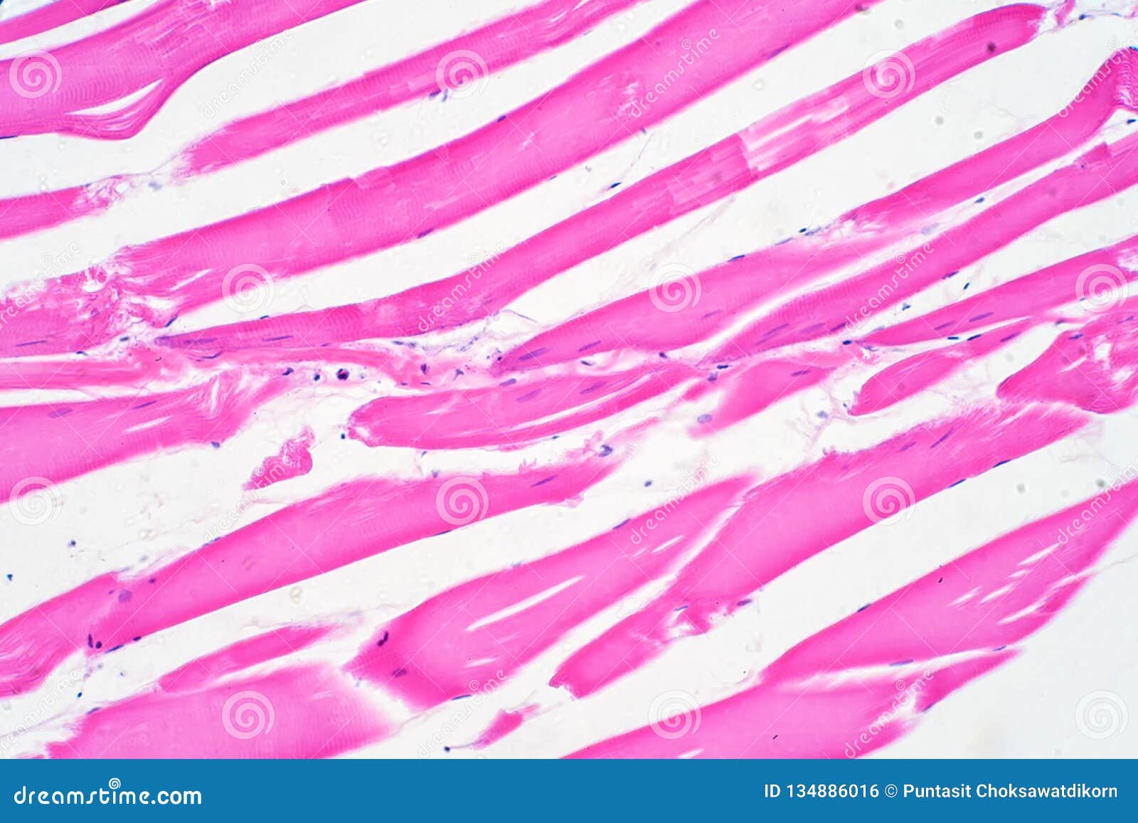 Histology of Skeletal Muscle Under Microscope View Stock Photo - Image ... Histology of Skeletal Muscle Under Microscope View Stock Photo - Image ...