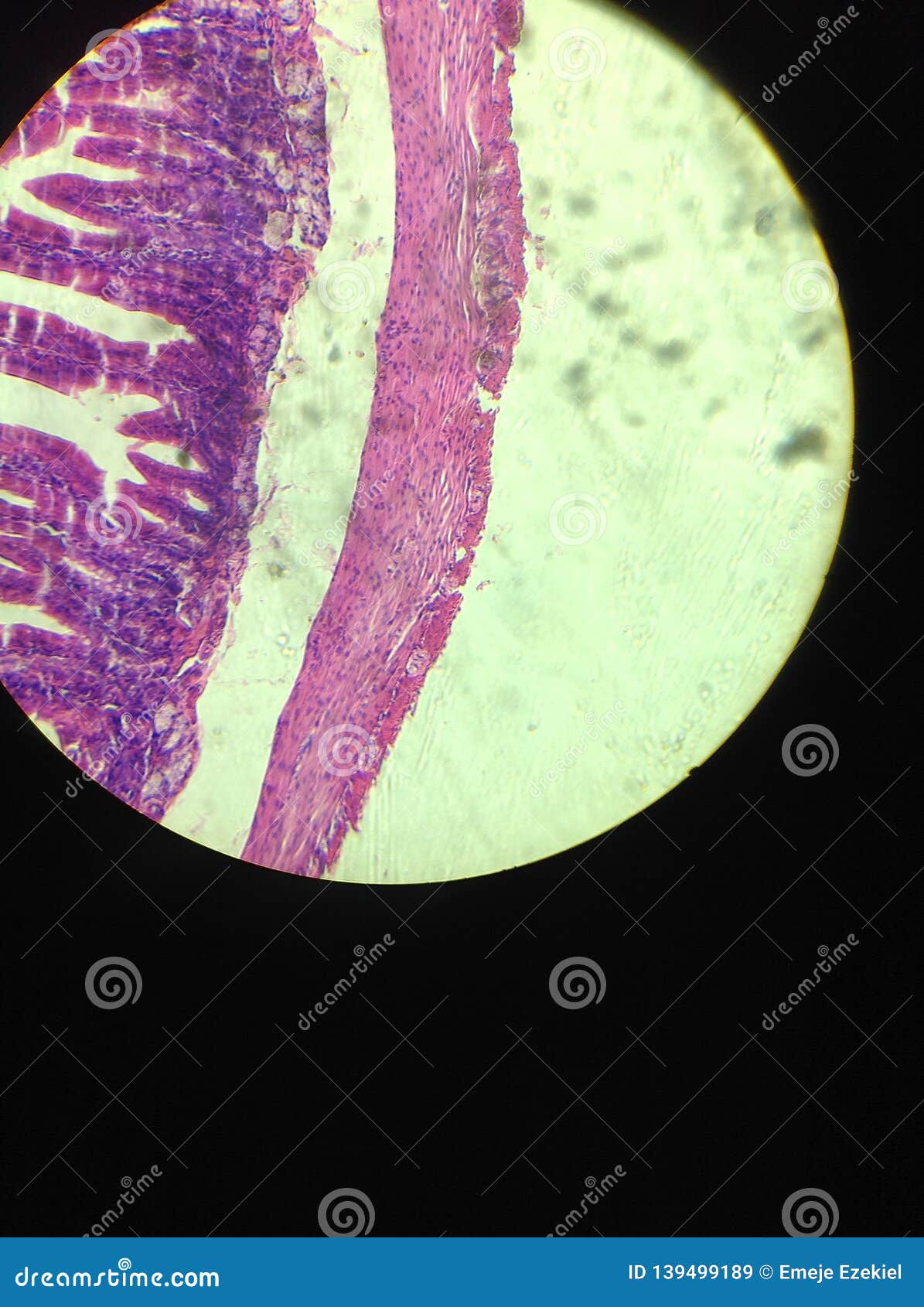 Histology stock image. Image of jejunum, small, intestine - 139499189