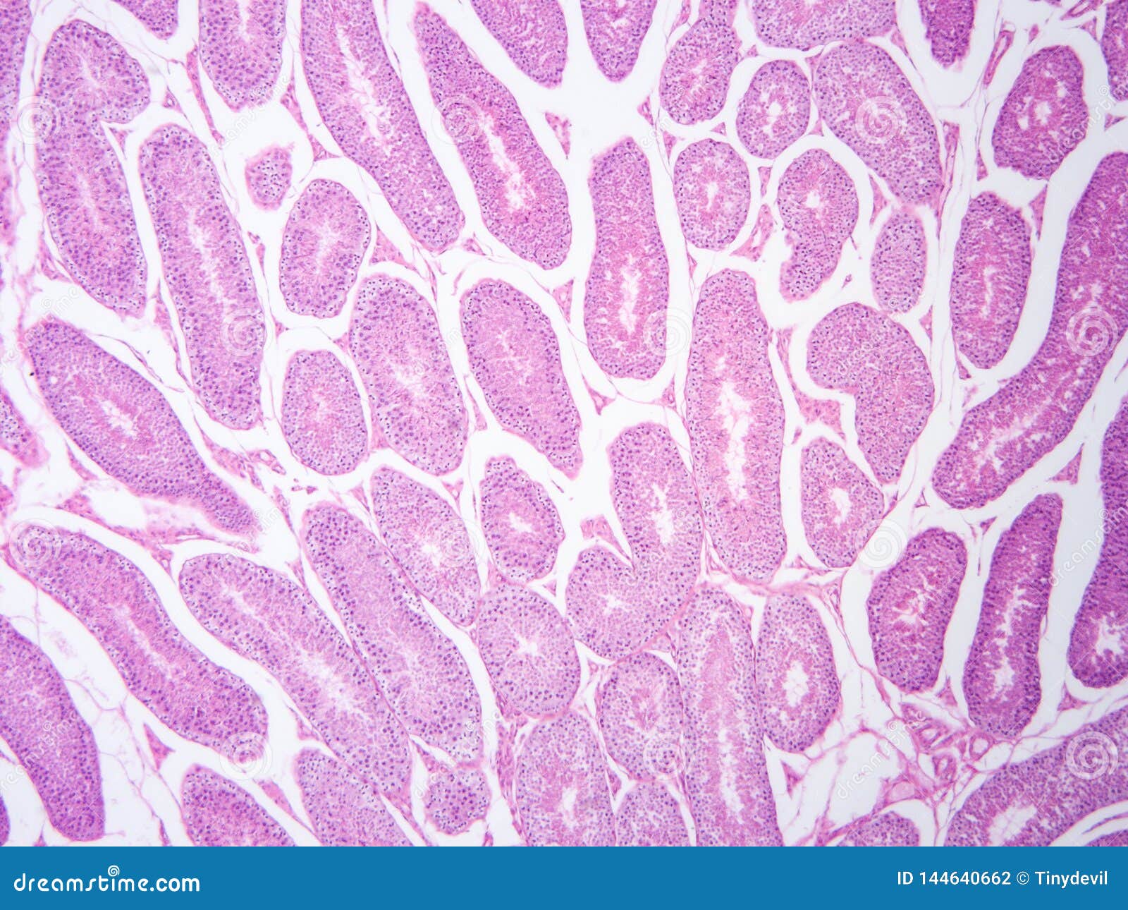 Histology of Testis Human Tissue Stock Photo - Image of human, ovary ...