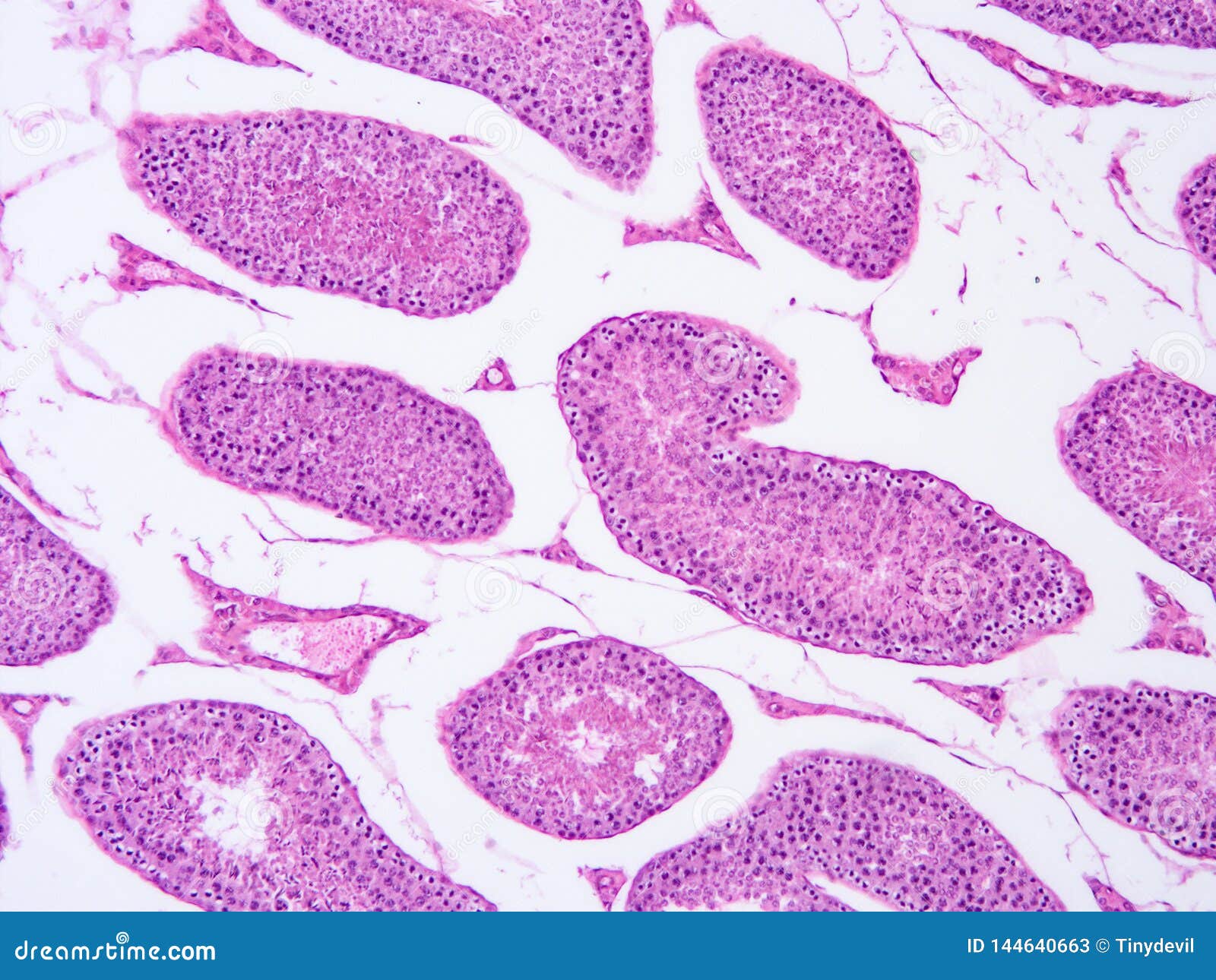 Histology of Testis Human Tissue Stock Image - Image of pathology ...
