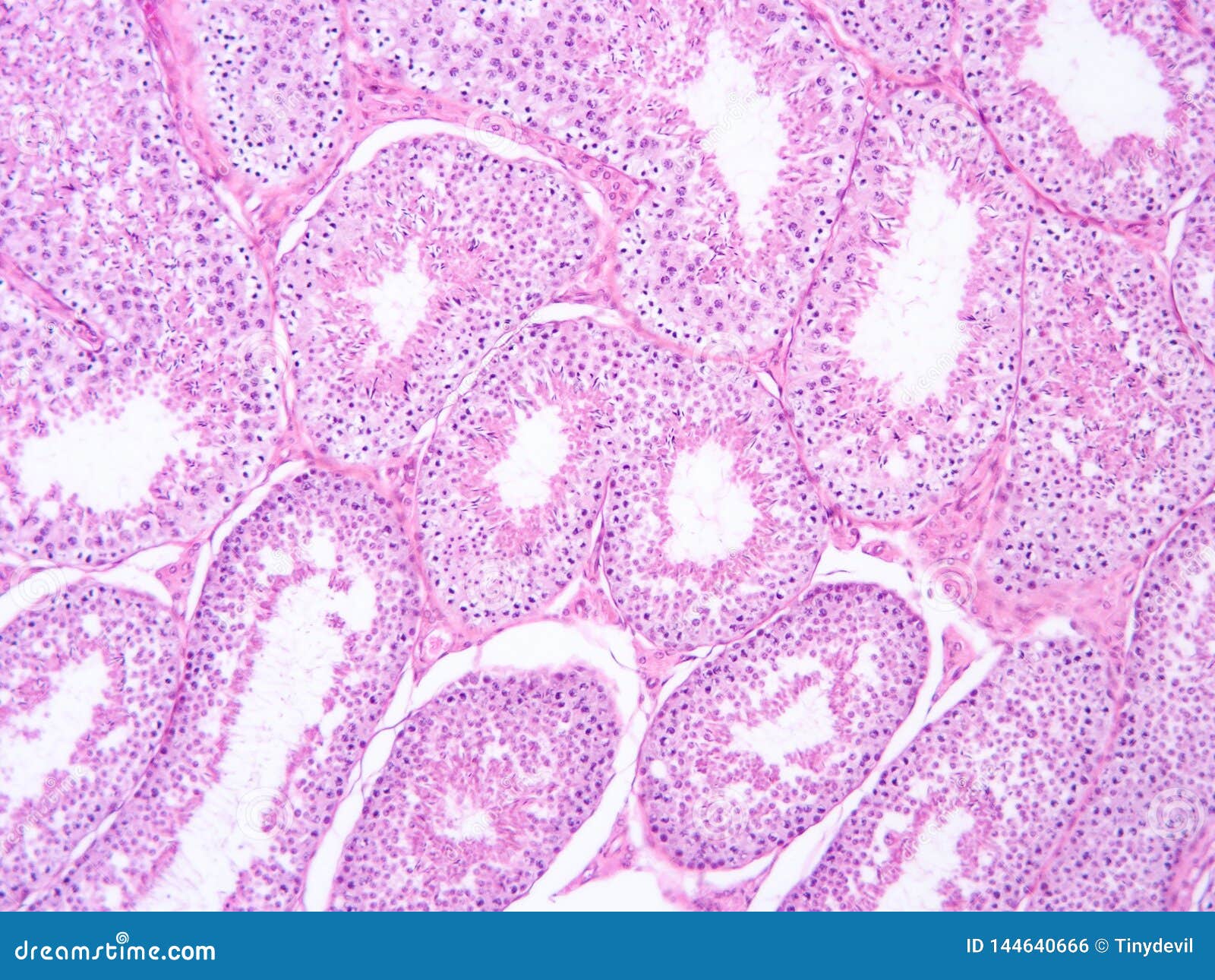 Histology of Testis Human Tissue Stock Photo - Image of columnar ...