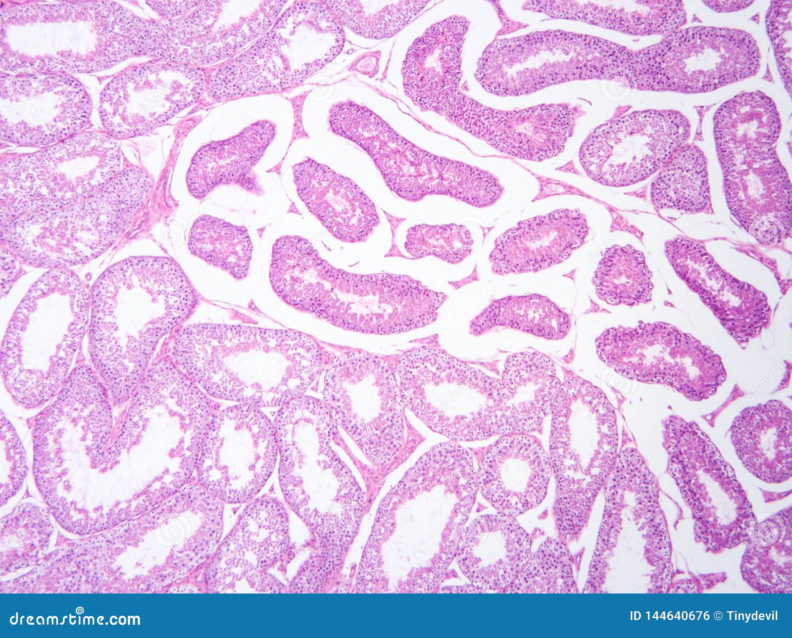 Histology of Testis Human Tissue Stock Photo - Image of ovary ...