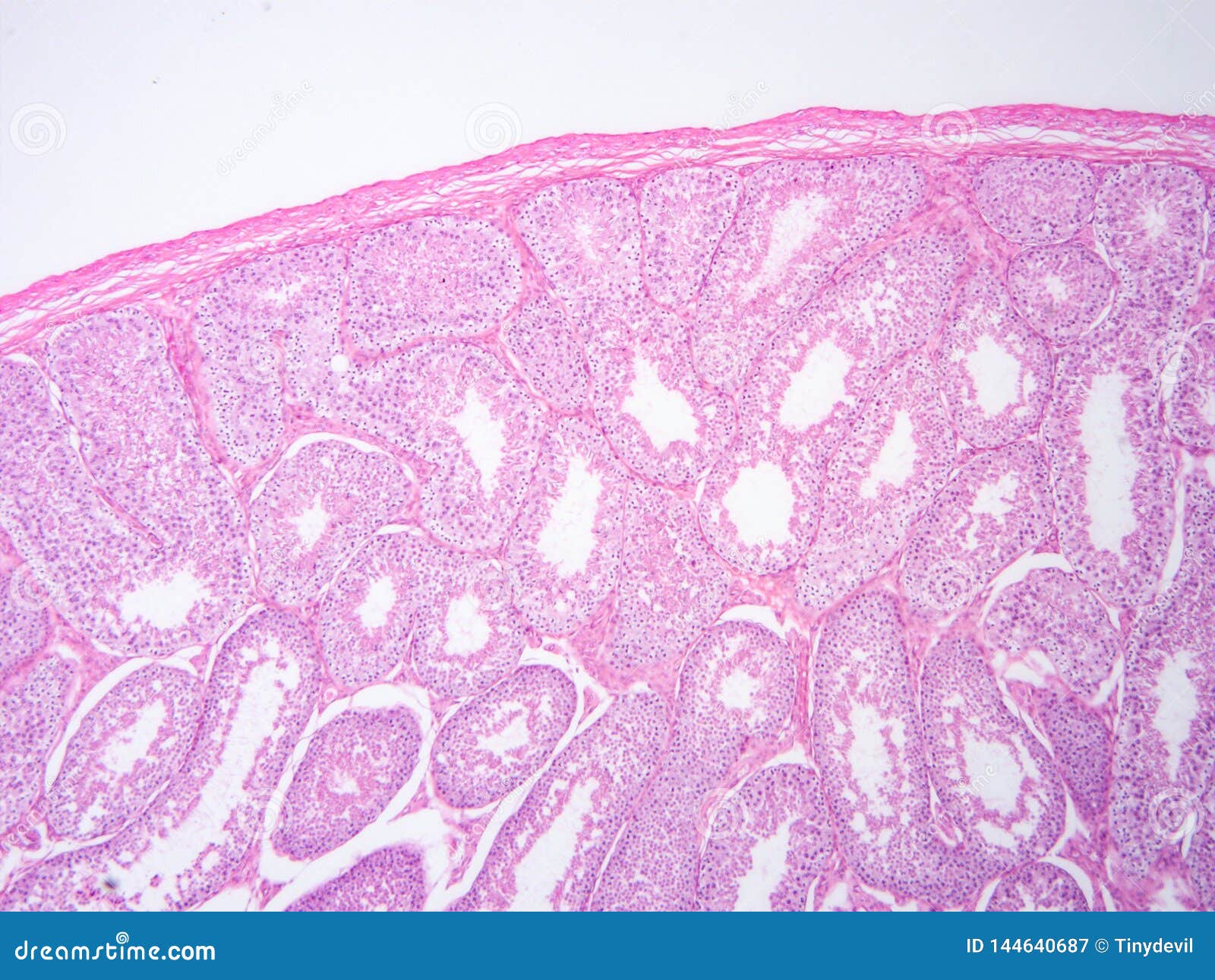 Histology of Testis Human Tissue Stock Image - Image of testis ...