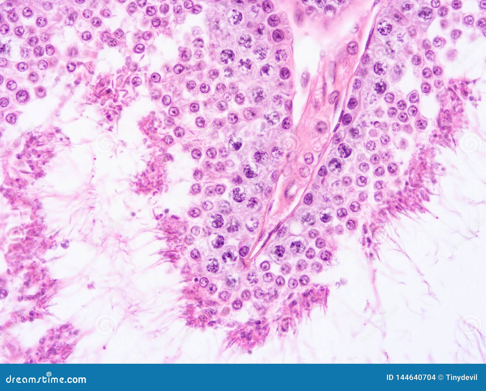 Histology of Testis Human Tissue Stock Photo - Image of nucleus ...