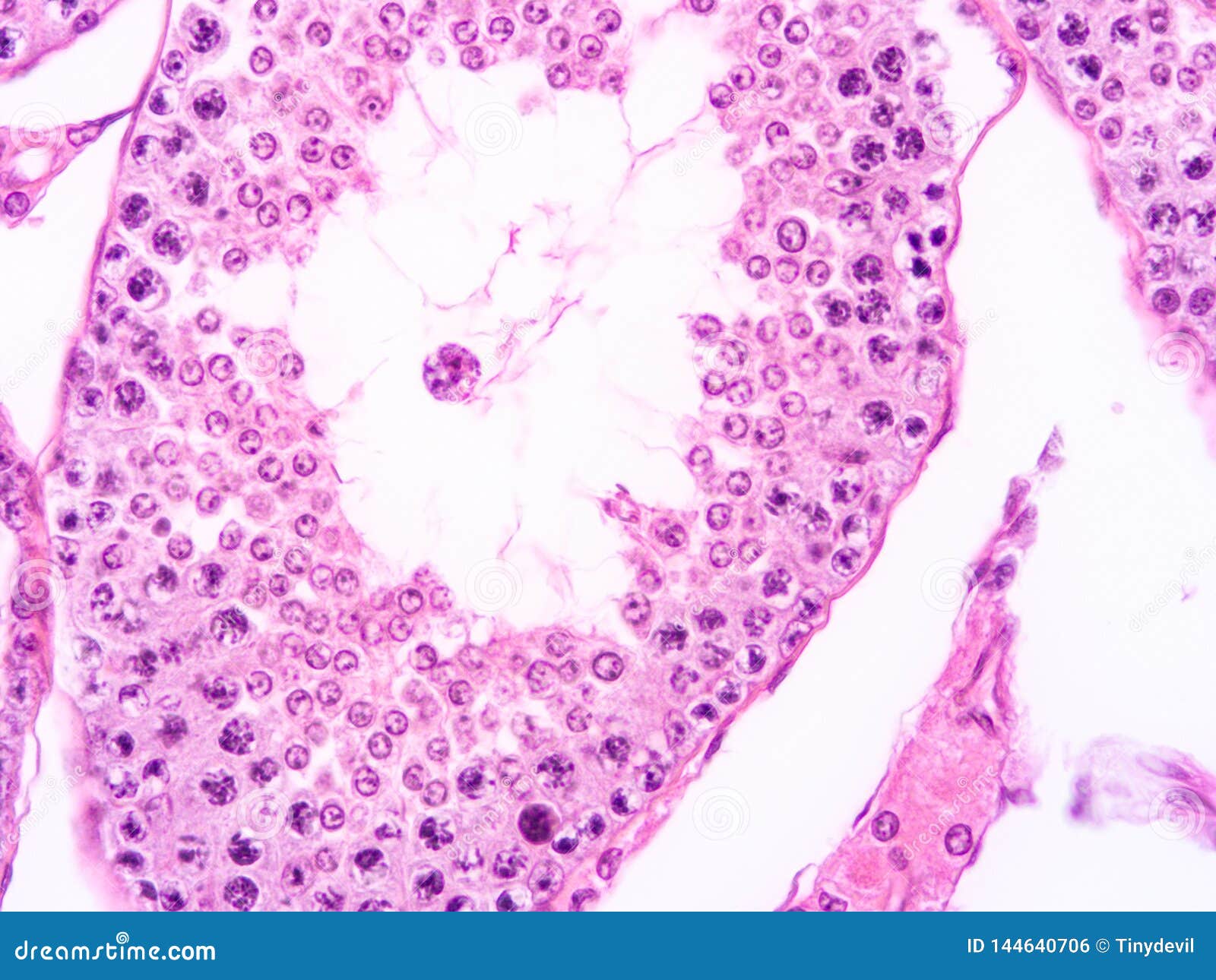 Histology of Testis Human Tissue Stock Photo - Image of research ...