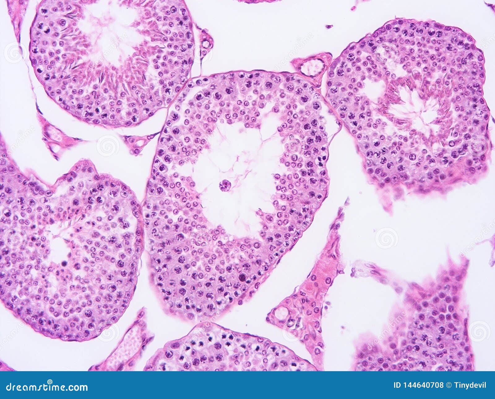 Histology of Testis Human Tissue Stock Photo - Image of pathology ...