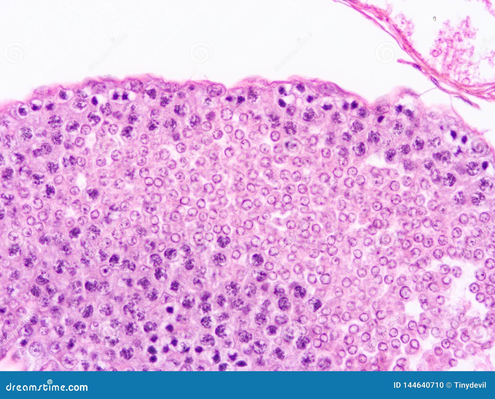 Histology of Testis Human Tissue Stock Photo - Image of show, medical ...
