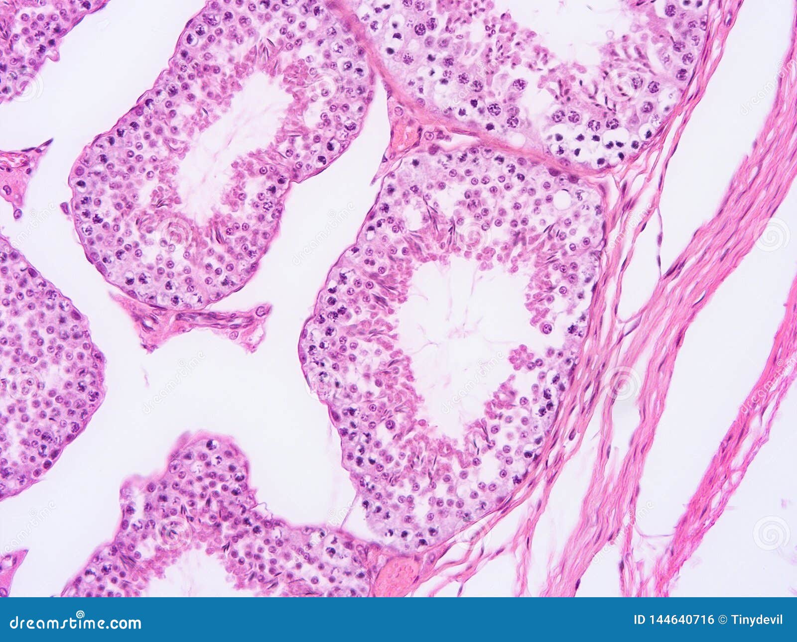 Histology of Testis Human Tissue Stock Photo - Image of show, columnar ...