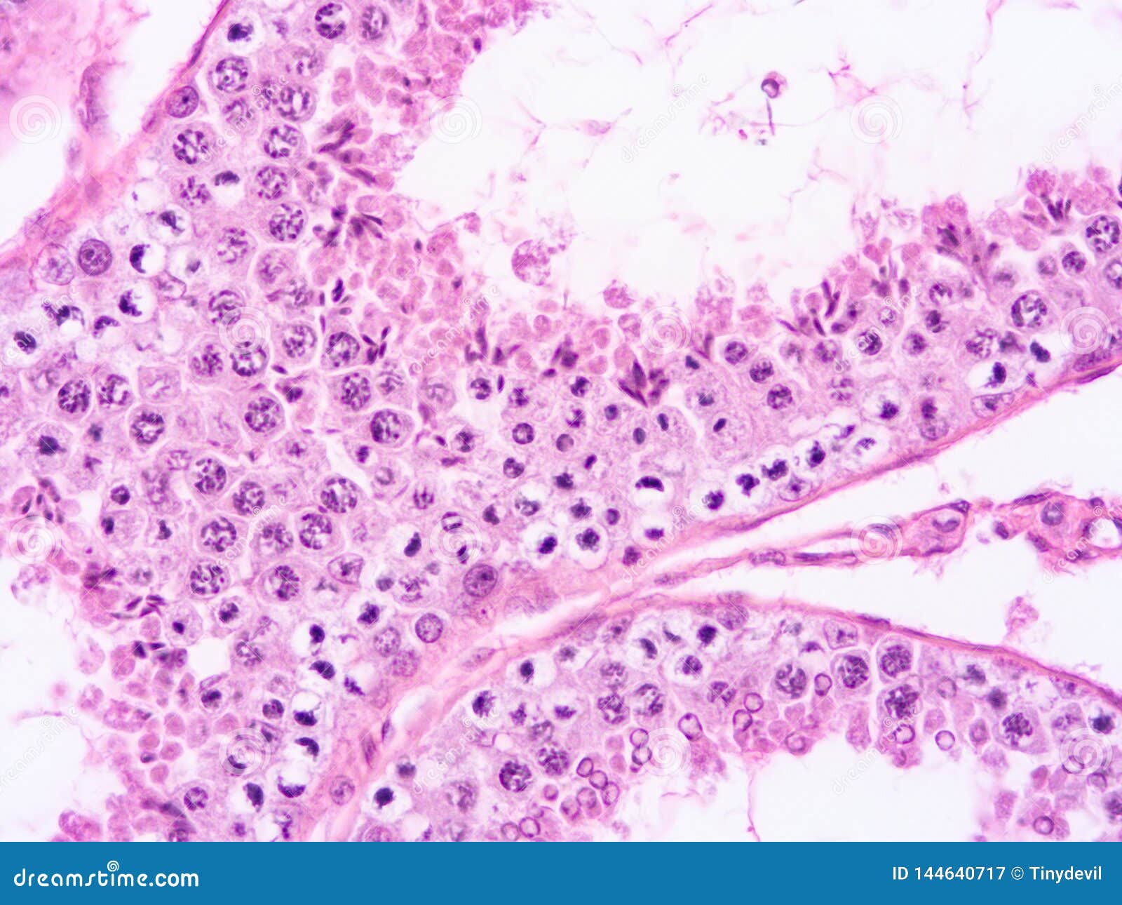 Histology of Testis Human Tissue Stock Image - Image of cell, human ...