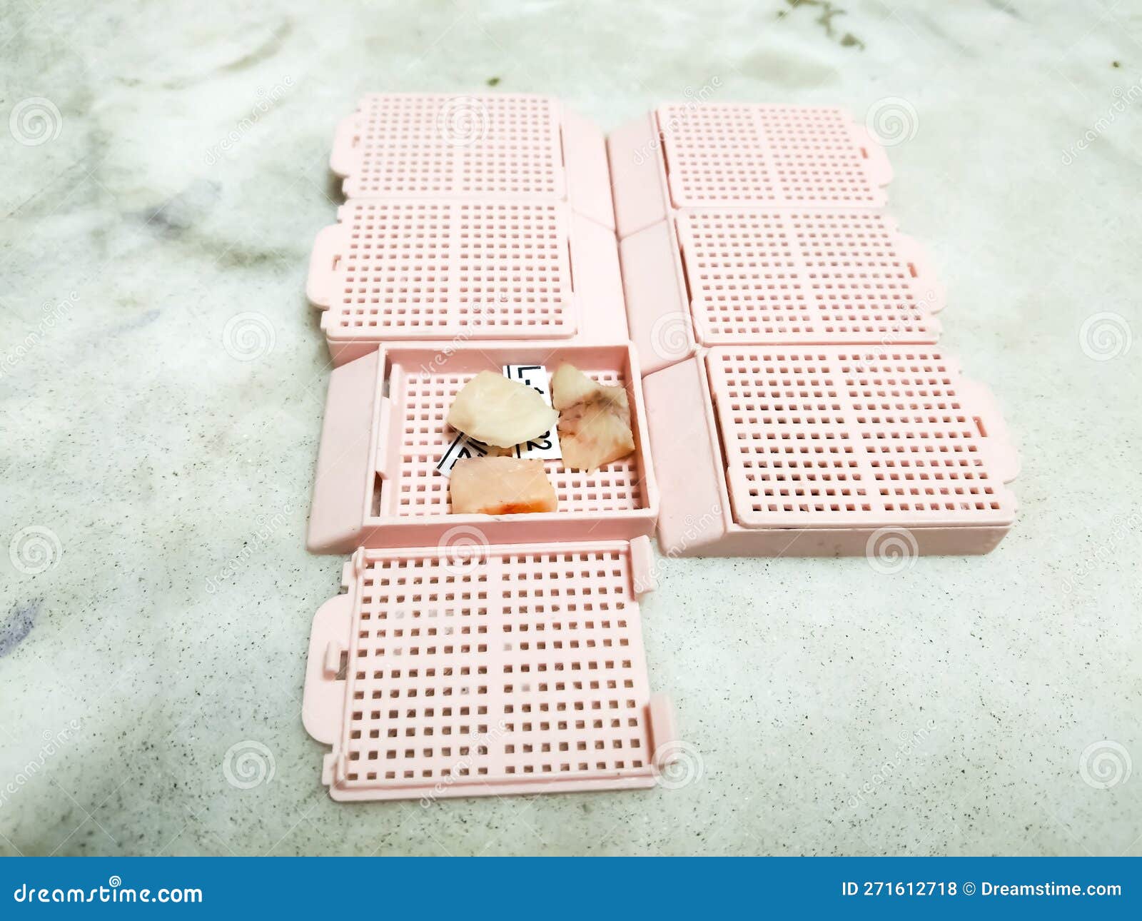 Histology Tissue Processing Embedding Cassettes. Stock Photo - Image of ... Histology Tissue Processing Embedding Cassettes. Stock Photo - Image of ...