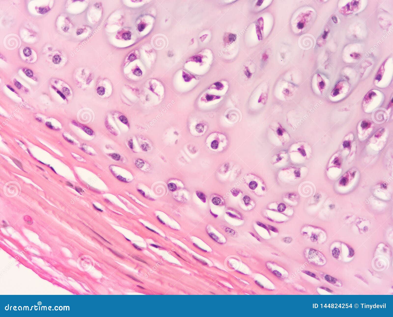 Trachea Histology Slide