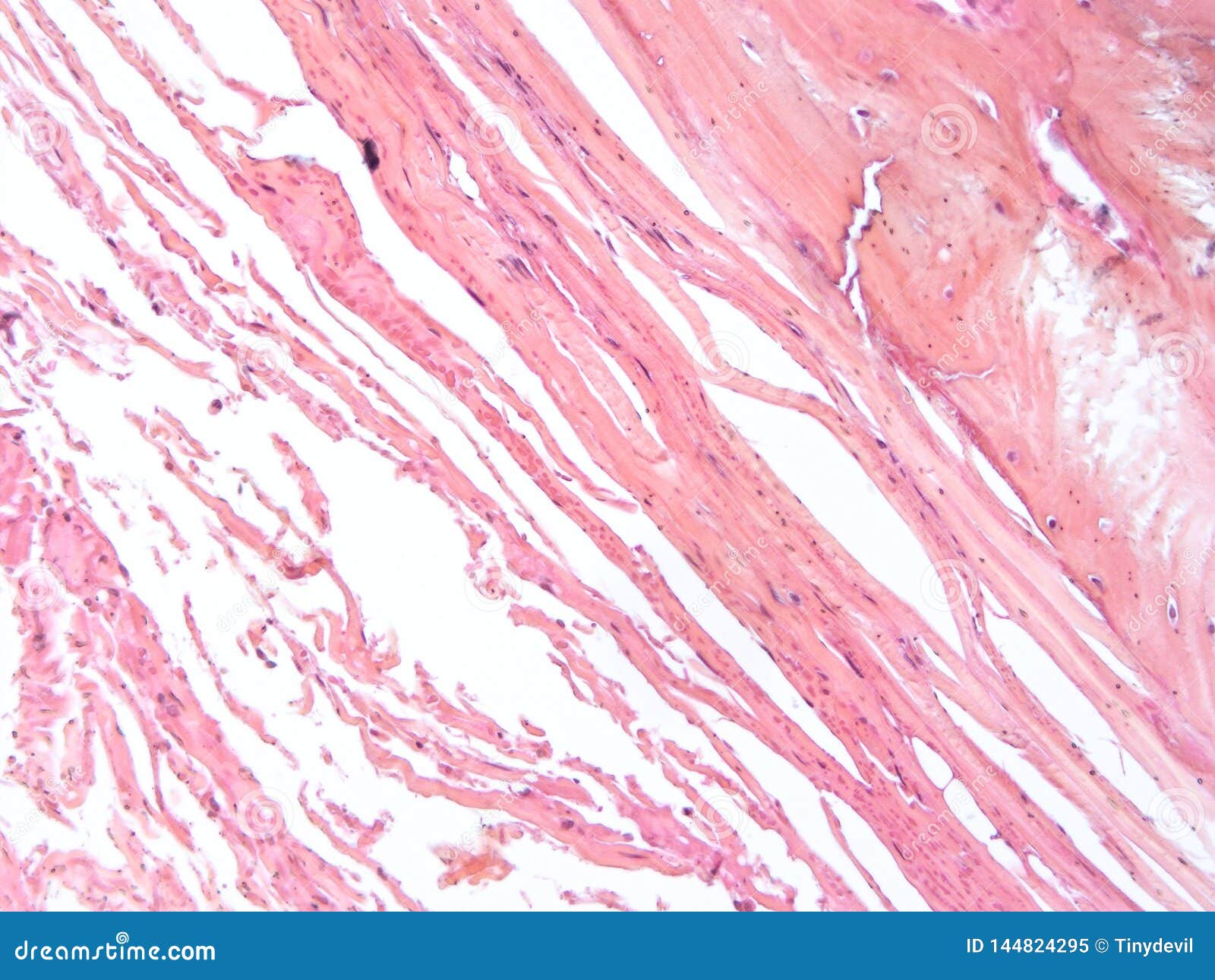 Histology of Trachea Human Tissue Stock Image - Image of pathology ...