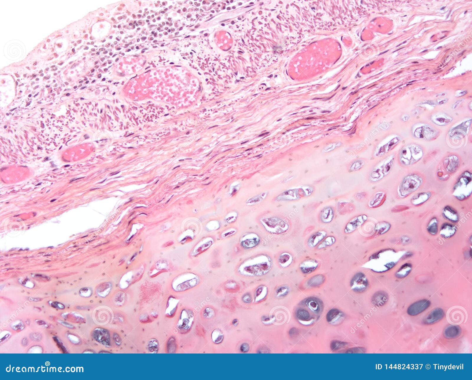 Histology of Trachea Human Tissue Stock Image - Image of view, columnar ...