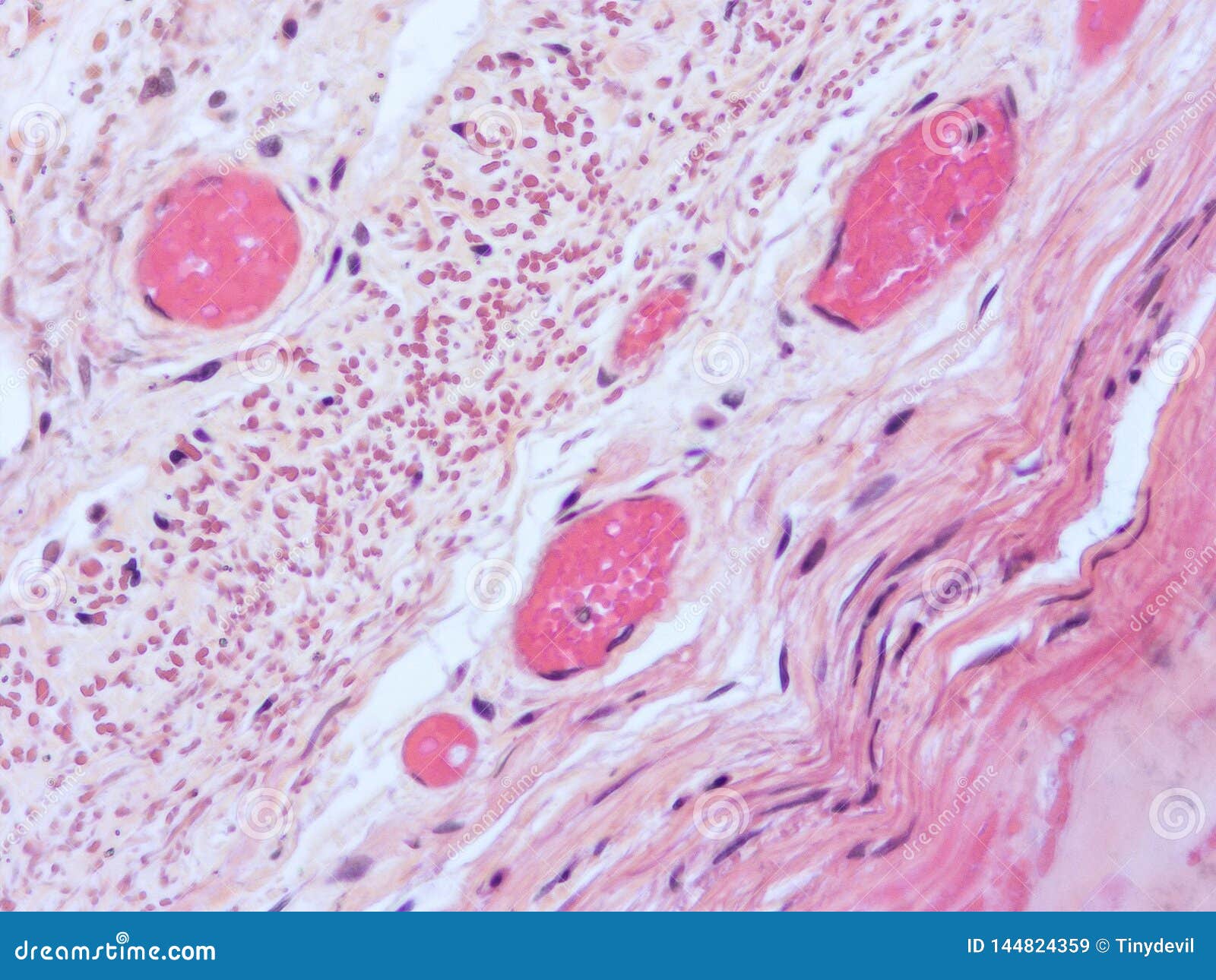 Histology Of Trachea Human Tissue Stock Photography | CartoonDealer.com ...