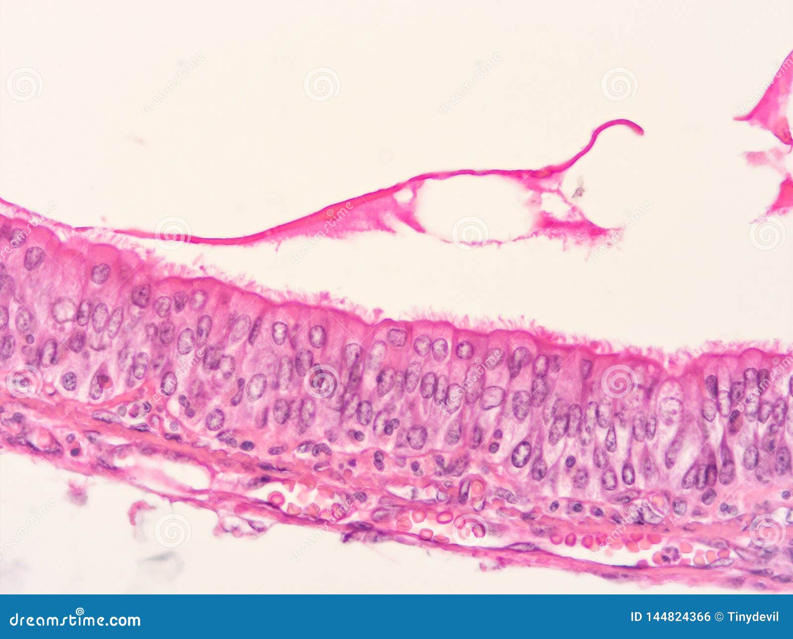 Histology of Trachea Human Tissue Stock Photo - Image of human, medical ...