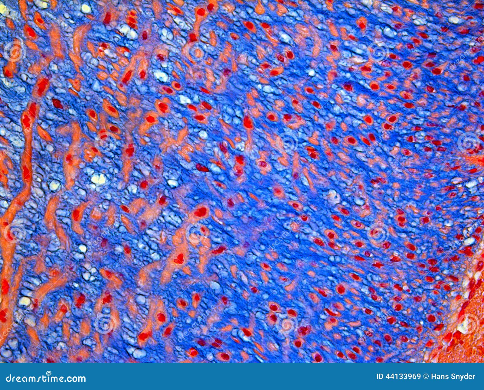 Histology of a Umbilical Cord Stock Image - Image of medical, technique ...