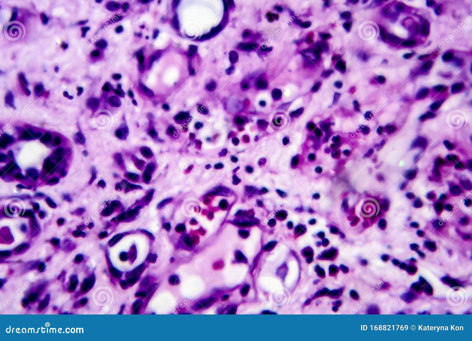 Interstitial Cells Histology