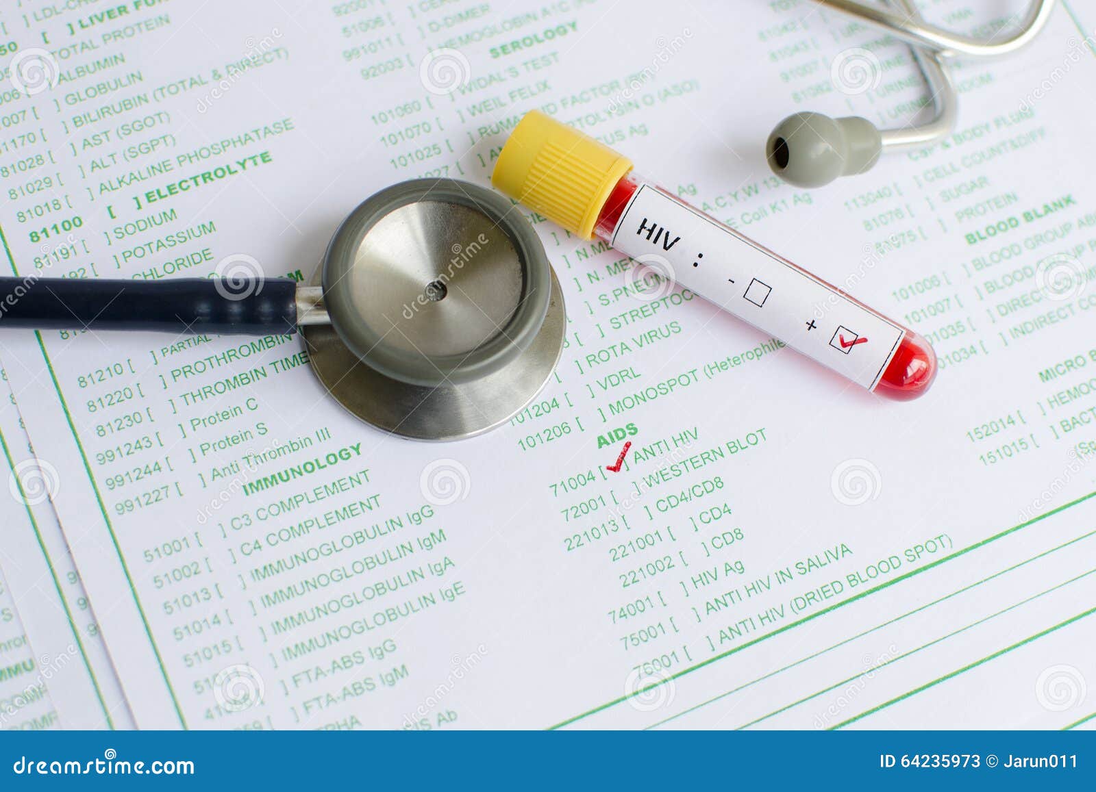 HIV blood sample stock image. Image of equipment, infection - 64235973