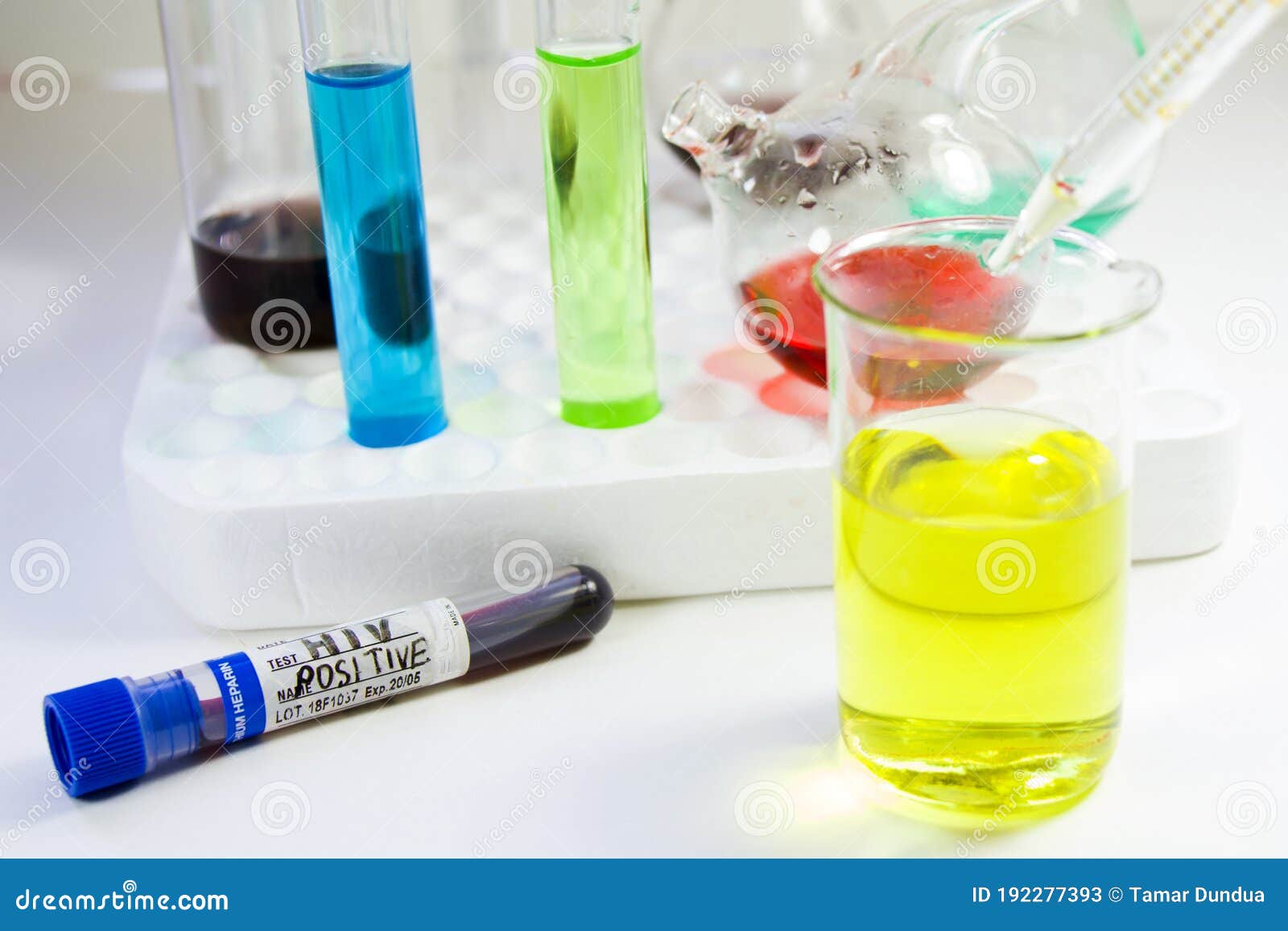 HIV Blood Test Tube Sample, Aids and Immune Viruses Stock Image - Image ...