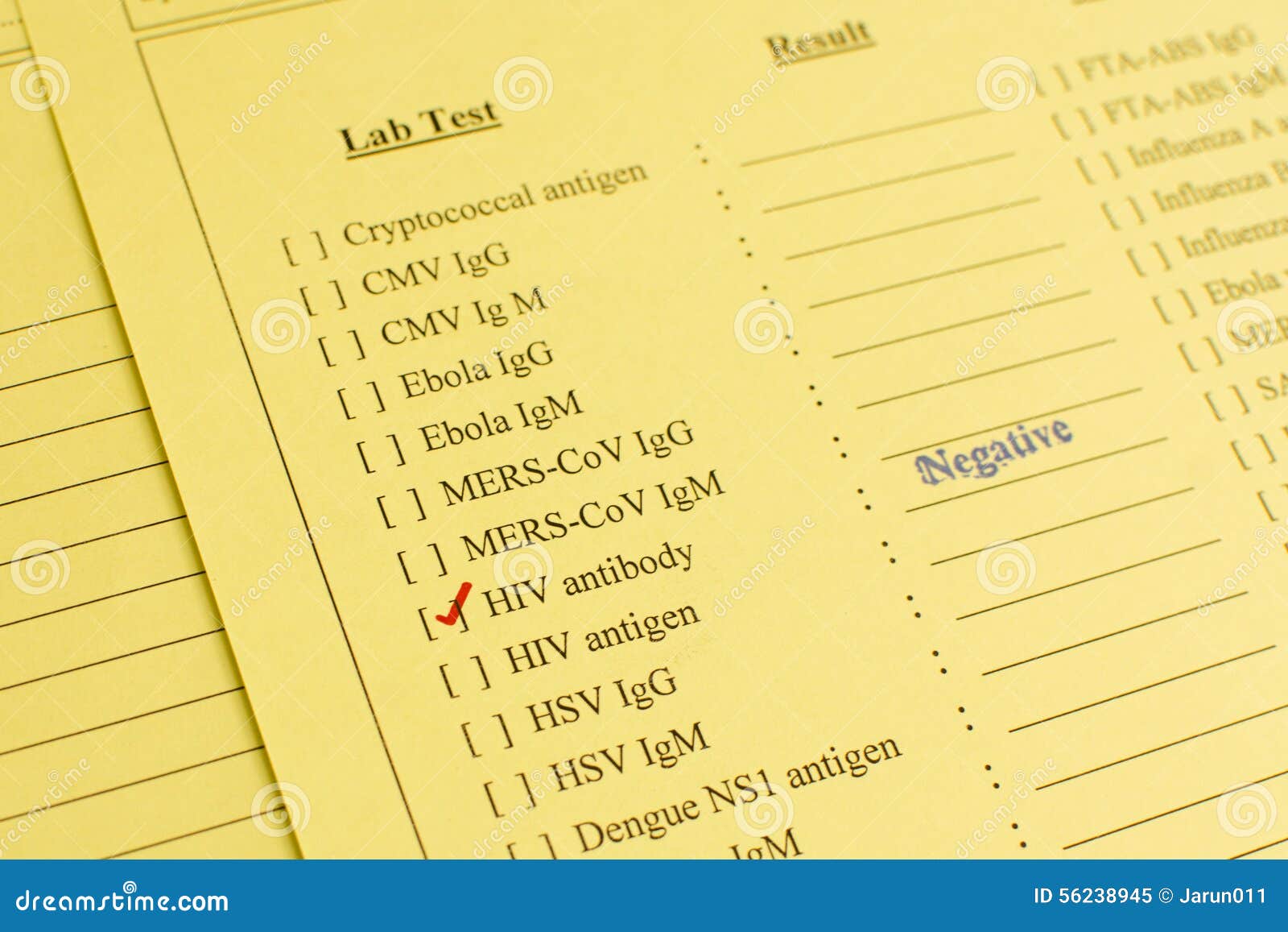 HIV negative stock image. Image of immunology, patient - 56238945