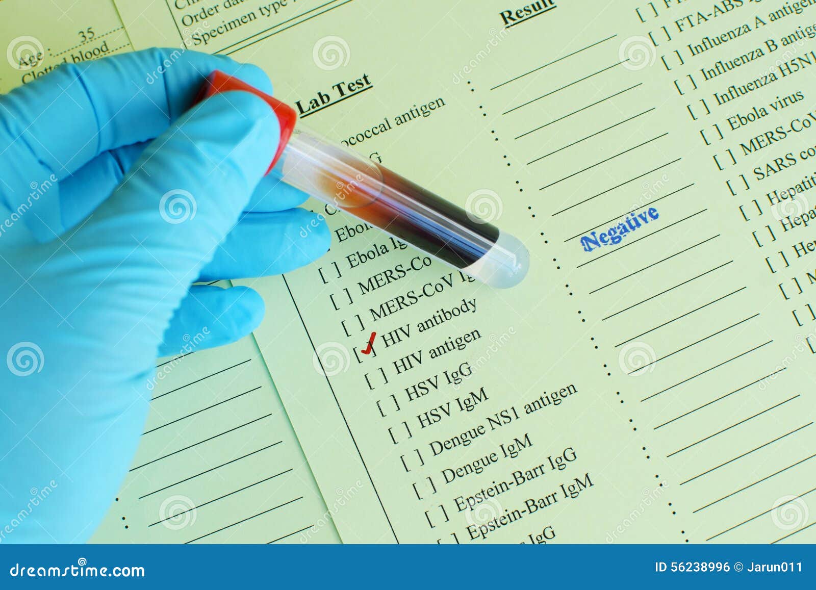 HIV negative stock photo. Image of negative, infection - 56238996