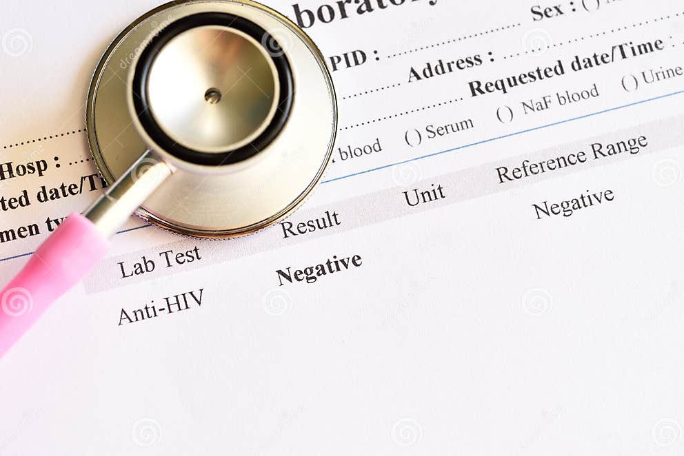 HIV negative test result stock image. Image of disease - 141386469