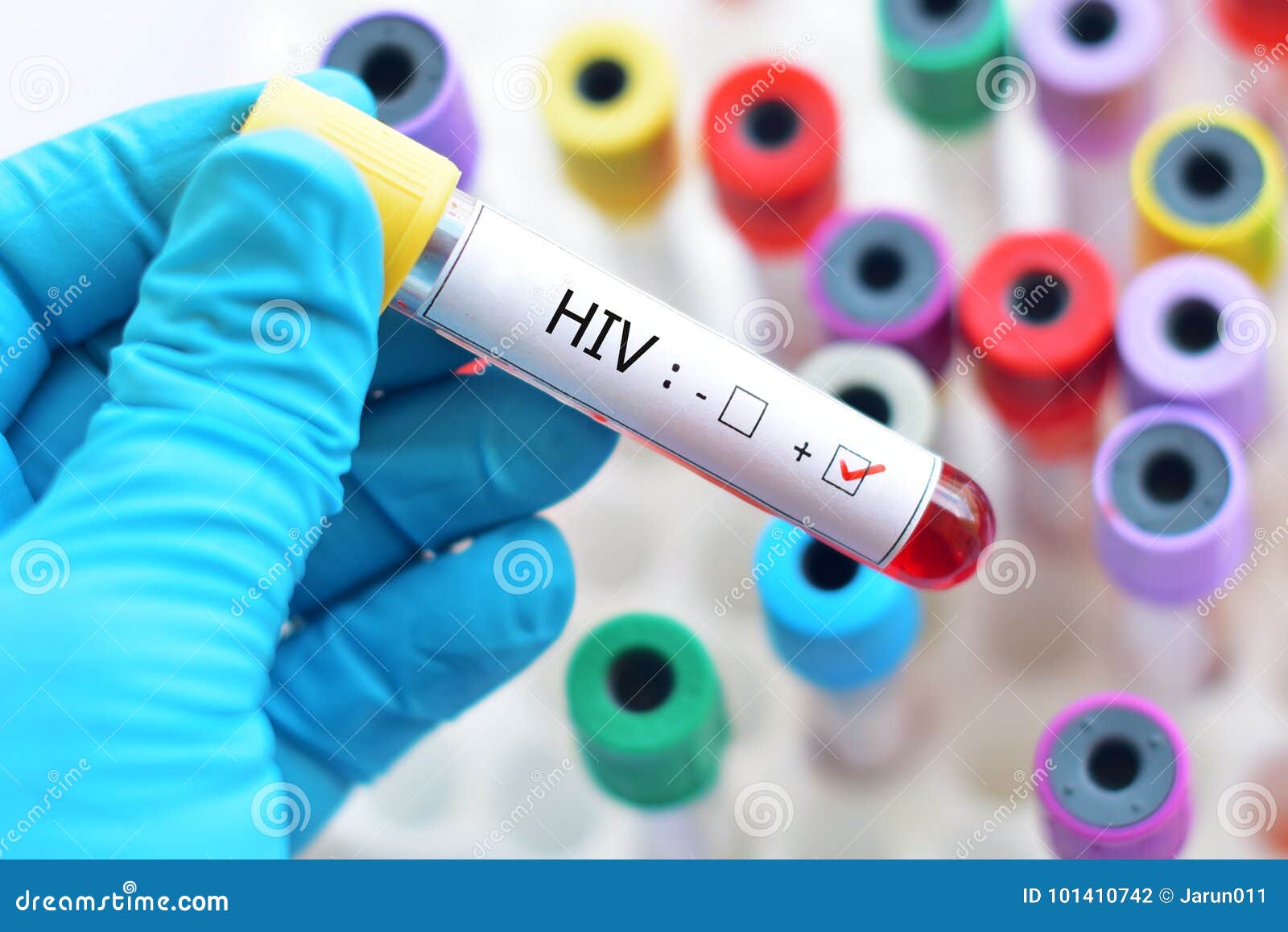 HIV positive stock photo. Image of exam, diseases, checkup - 101410742