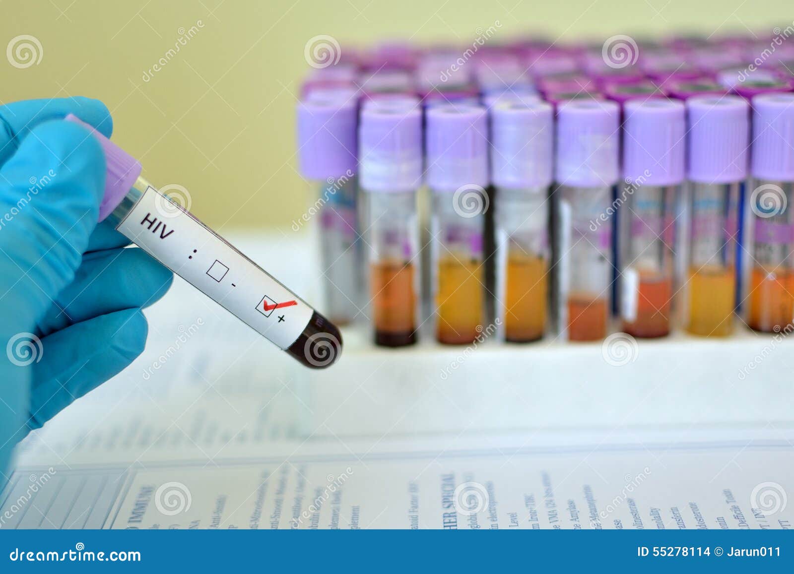 HIV positive stock photo. Image of organism, blood, laboratory - 55278114