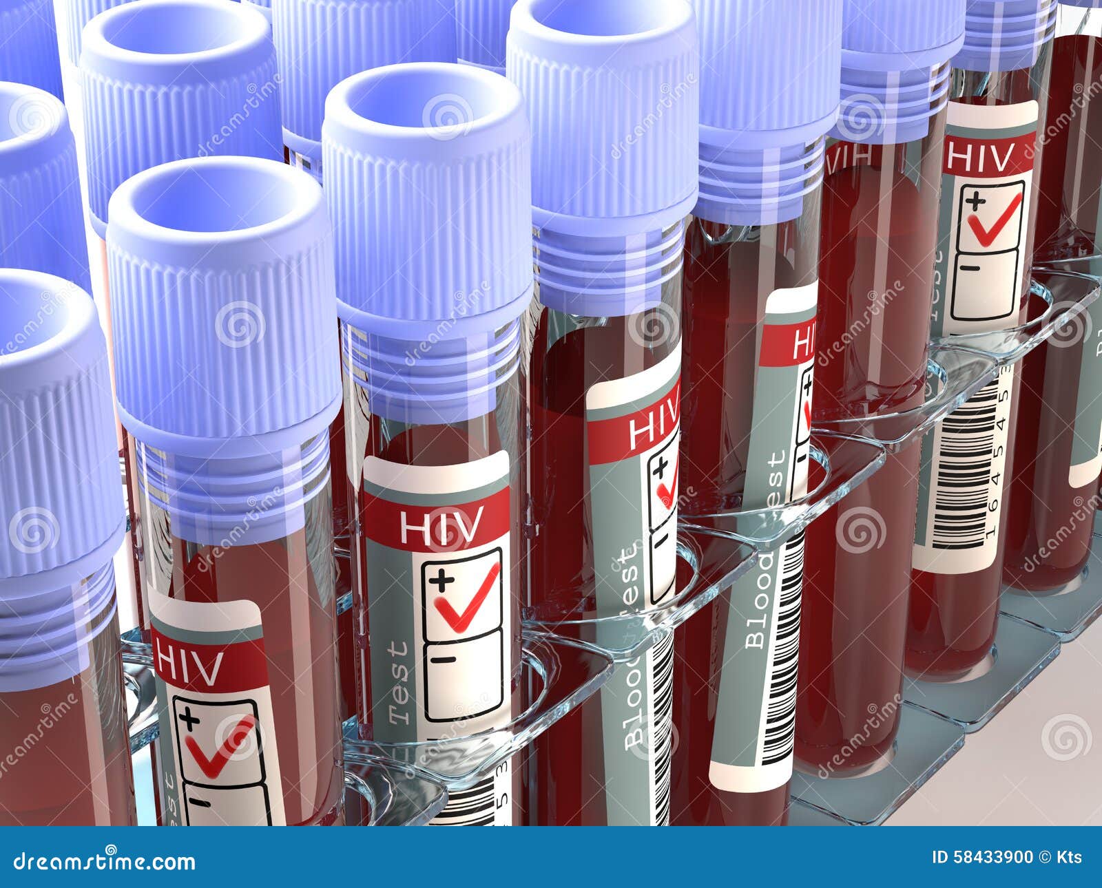 HIV Positive stock photo. Image of blood, infection, reactive - 58433900