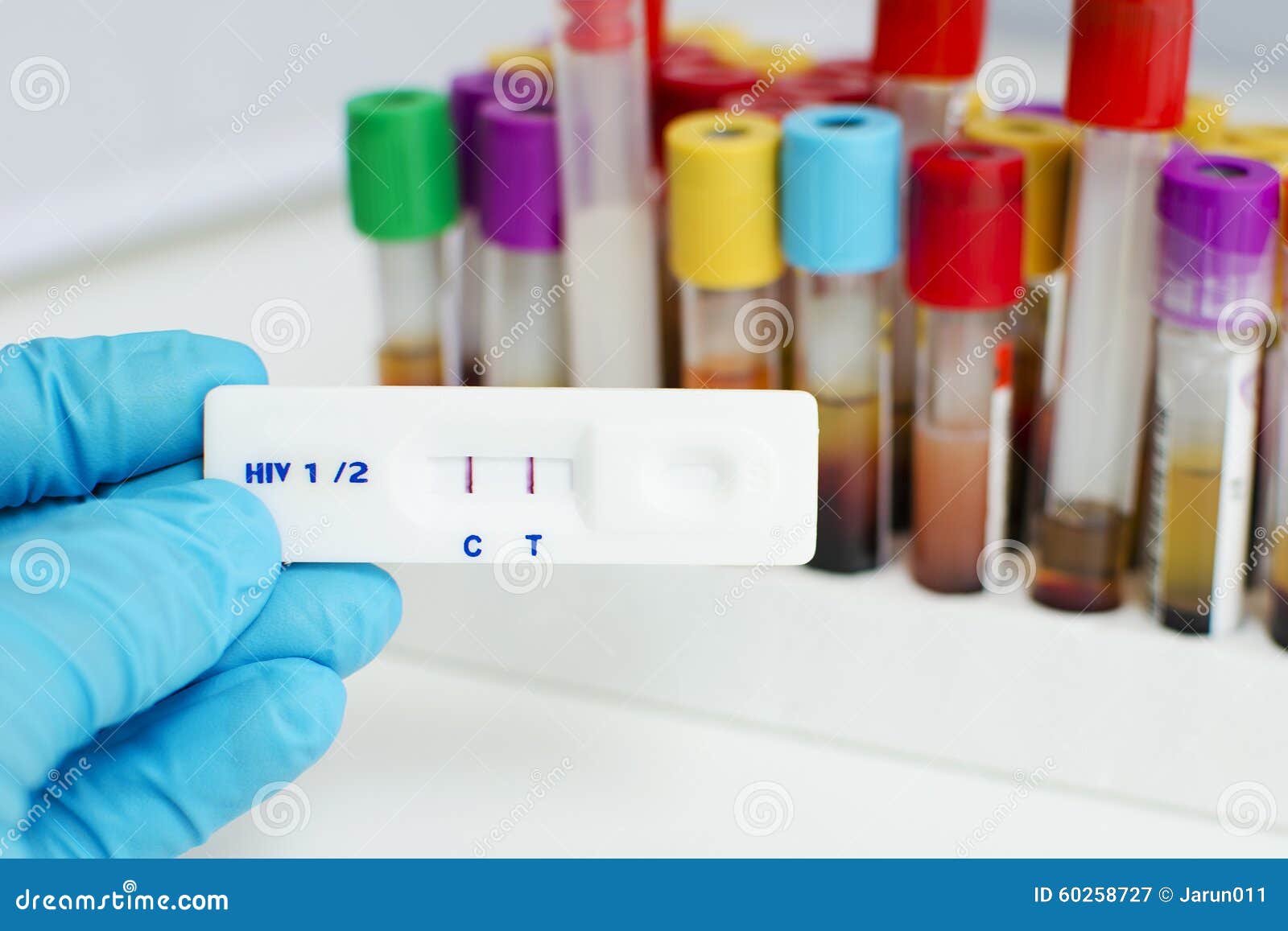 HIV testing positive stock image. Image of positive, cassette - 60258727