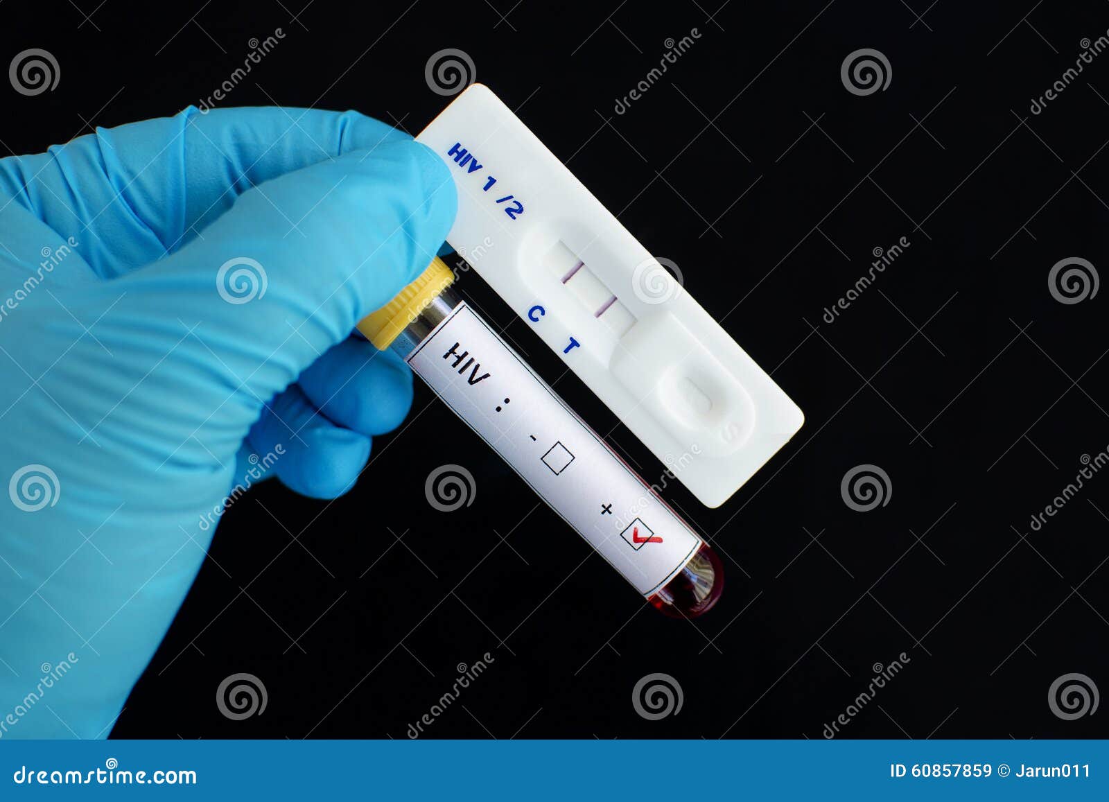HIV testing positive stock image. Image of disease, blood - 60857859