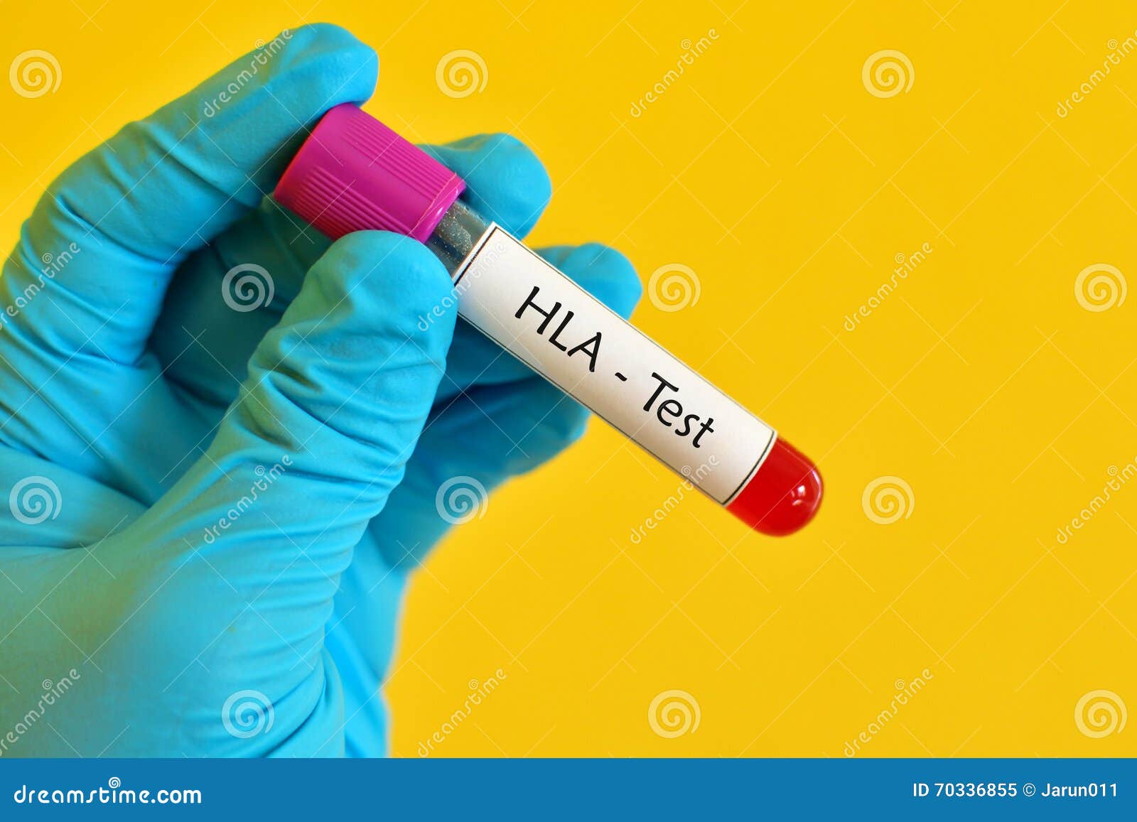 HLA test stock image. Image of hopeless, damage, autism - 70336855