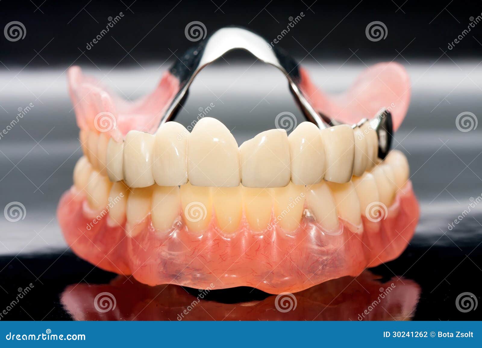 Tand prothese stock foto. Image of hygiëne, wetenschap - 30241262