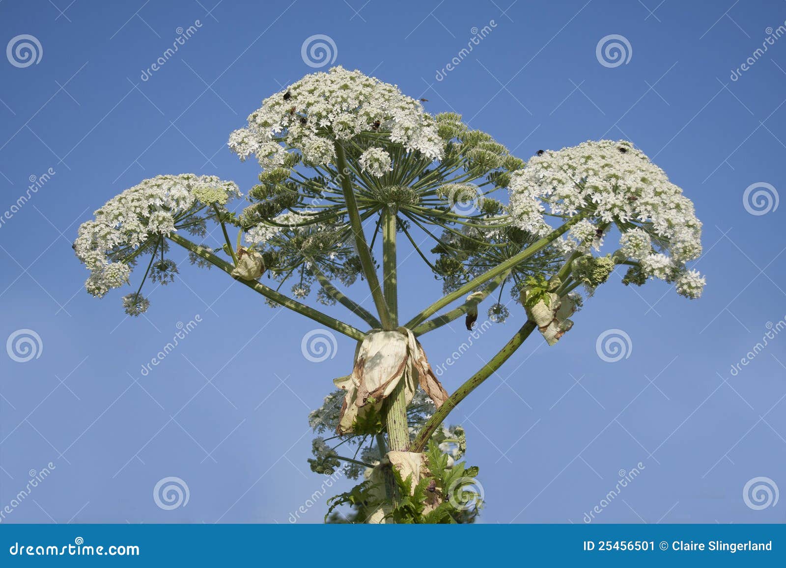 119 Phytophotodermatitis Stock Photos - Free & Royalty-Free Stock ...