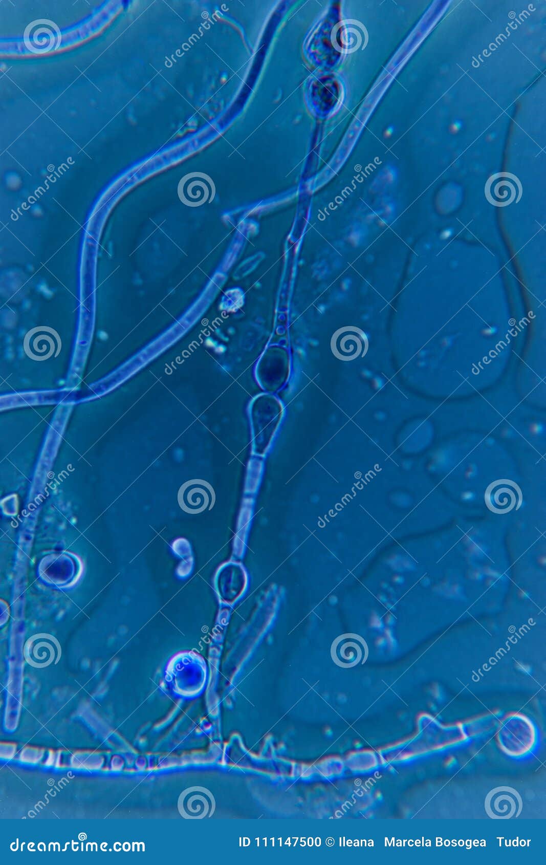 Hojas Putrefactas En El Microscopio Foto de archivo - Imagen de ...