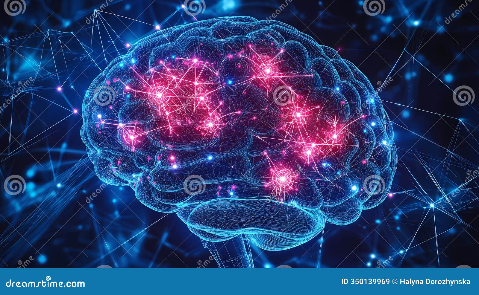 Hologram of the Brain.Exploring the Impact of Dementia on Cognitive ...