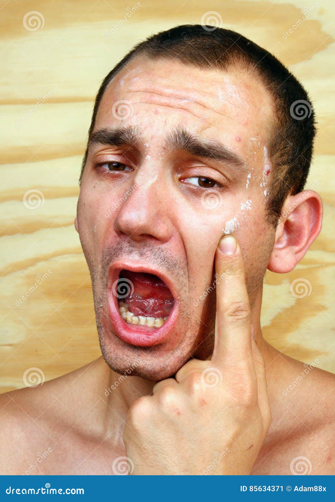 Hombre Con La Piel Infectada En La Cara Imagen de archivo - Imagen de ...