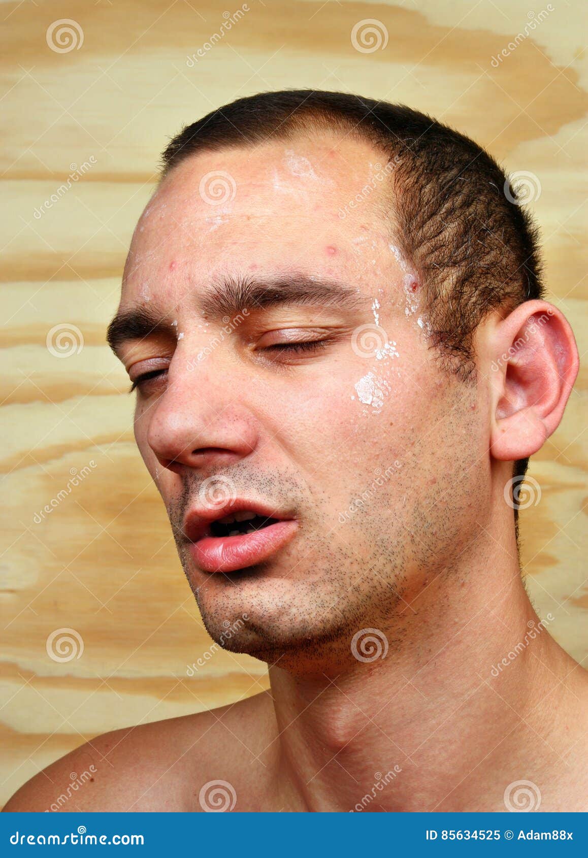 Hombre Con La Piel Infectada En La Cara Imagen de archivo - Imagen de ...