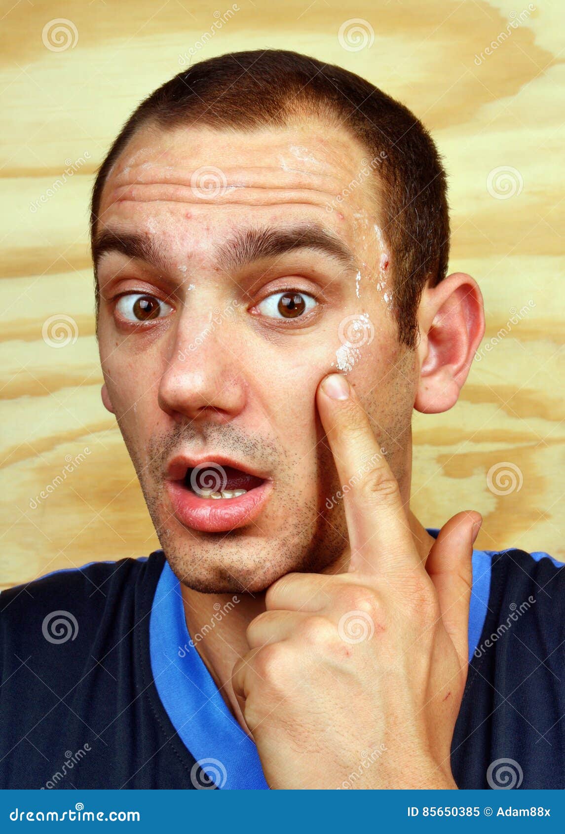 Hombre Con La Piel Infectada En La Cara Imagen de archivo - Imagen de ...