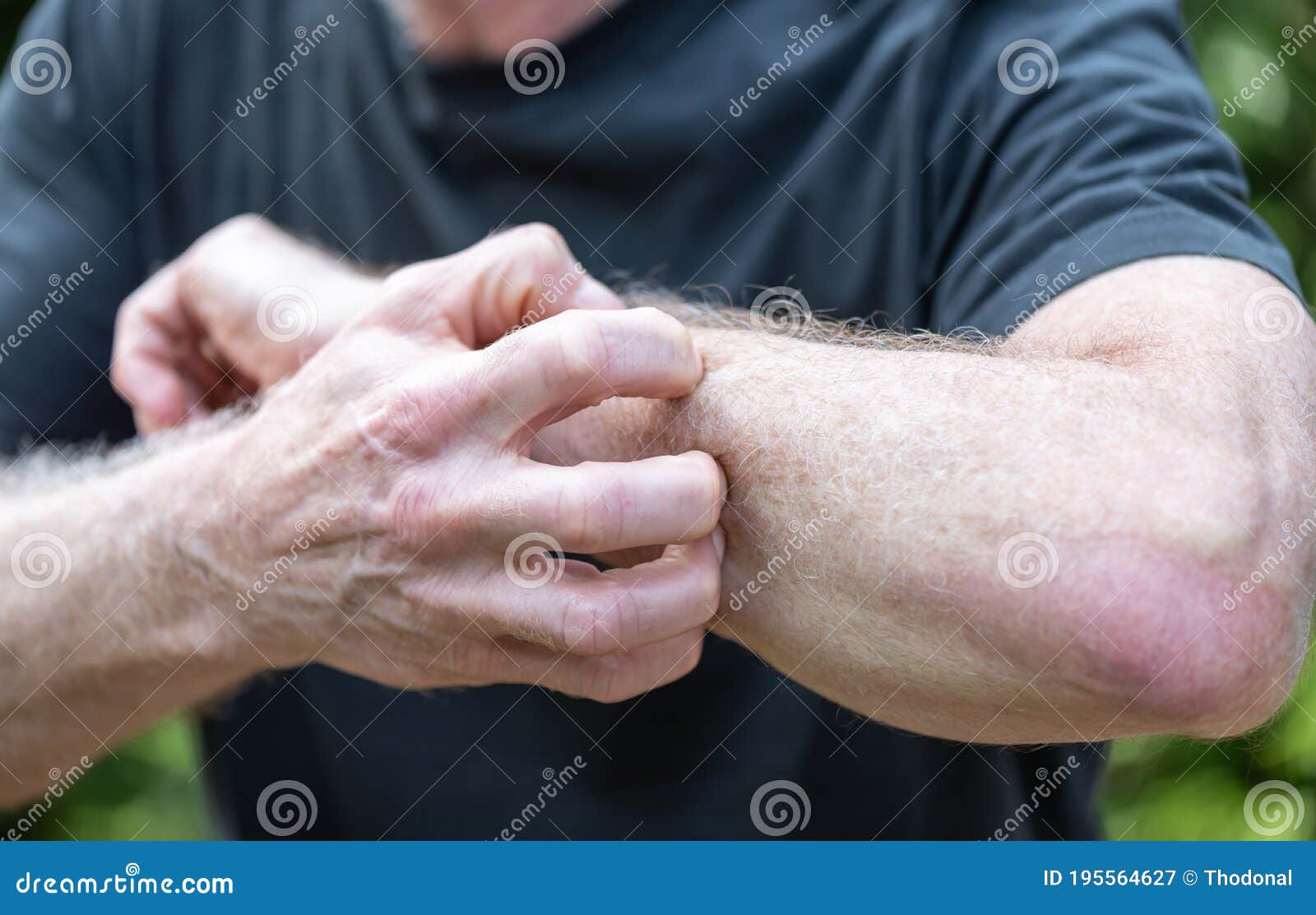 Hombre rascando su brazo imagen de archivo. Imagen de hombre - 195564627
