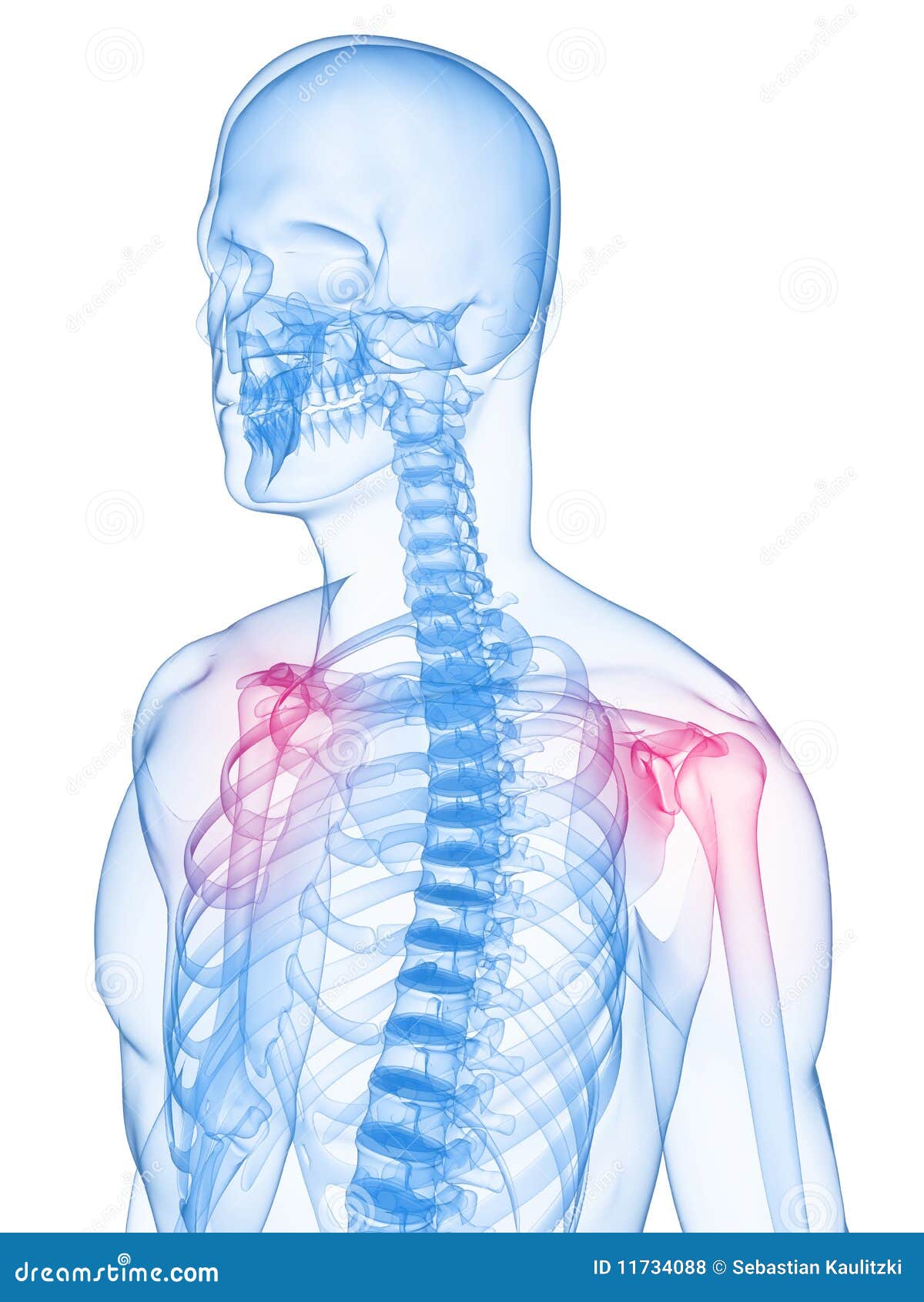 Hombros inflamados stock de ilustración. Ilustración de rayo - 11734088